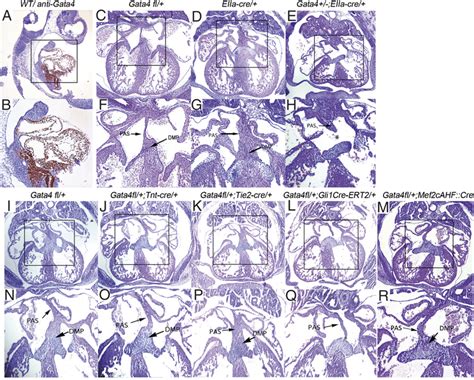 Gata4 Is Required In The Atrial Septum Progenitor Of Pshf For Atrial