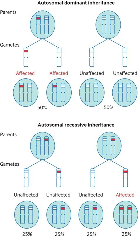 Ehlers Danlos Syndromes The Bmj