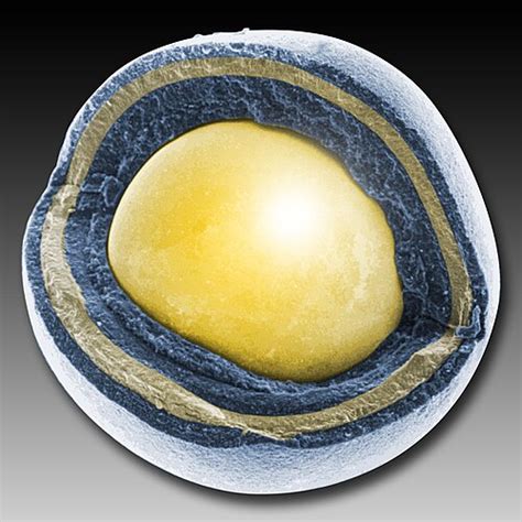 Triso Wikipedia Bahasa Indonesia Ensiklopedia Bebas