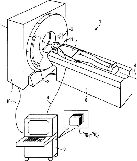 Method Of Producing Tomosynthesis Image Of Beating Heart And