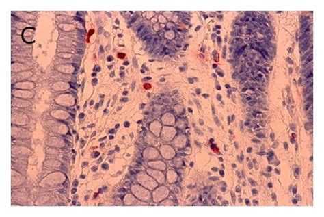 Immunohistochemical Staining For Human Mast Cell Tryptase Of Serial Download Scientific Diagram