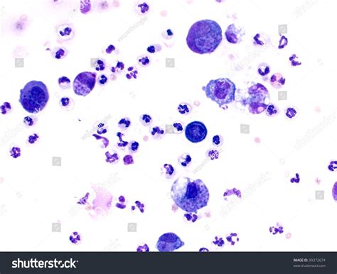 Toxoplasmosis Toxoplasmsa Gondii Within Macrophages Cytology Stock