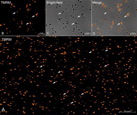 Confocal Imaging Of Tmrm Staining Of Purified P Massiliensis Virions Download Scientific