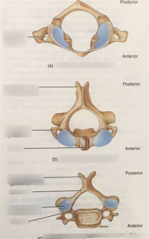 E 6 Atlas Axis And Cervical Vertebrae Labeling Colored Diagram Quizlet