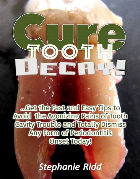 Buy Cure Tooth Decay Get The Fast And Easy Tips To Avoid The