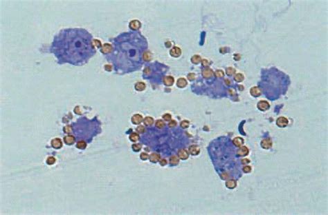 Principles Of Immunomagnetic Isolation A Positive And Negative