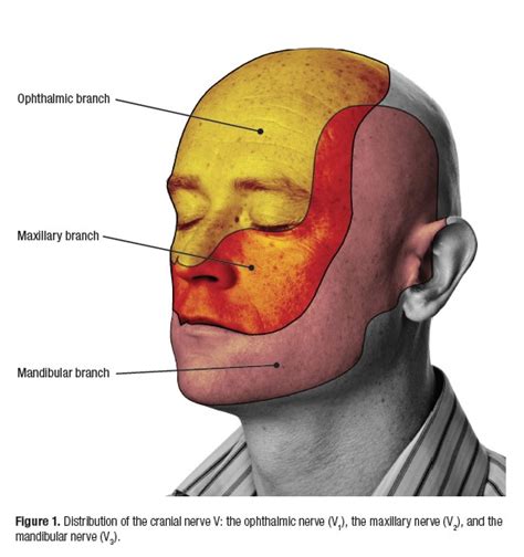Signs And Symptoms Of Trigeminal Neuralgia According To Experts