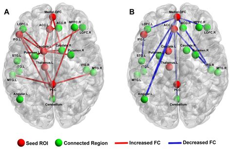 Functional Connectivity Difference Between Ocd Patients And Healthy