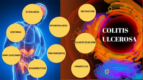 Colitis Ulcerosa By Alba Hoya On Prezi