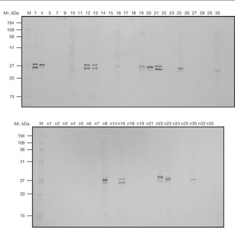 Western Blot Patterns Of Sds Page Separated Lysates Of Various