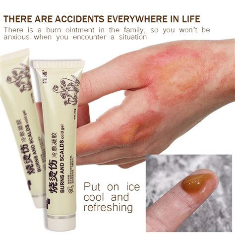 Burn Treatment Ointment In Pakistan At Juanita Morris Blog