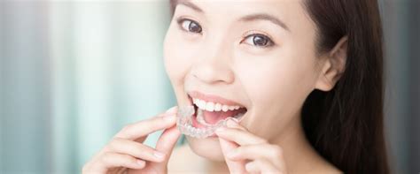 Achieve A Perfect Smile With Invisalign Clear Braces Your Guide To