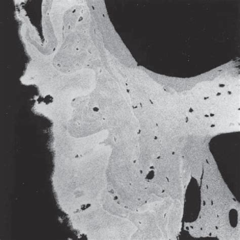 Pdf Scanning Electron Microscopy Of Bone