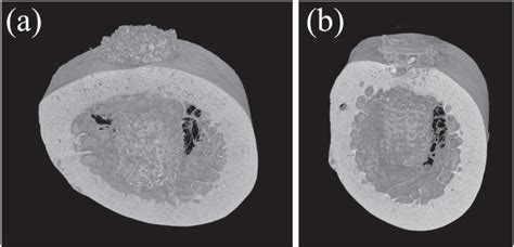 reconstructed μct scans of sectioned femurs with one foamed a and one