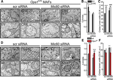 Mic60 And Opa1 Lie In The Same Genetic Pathway Controlling The Cj