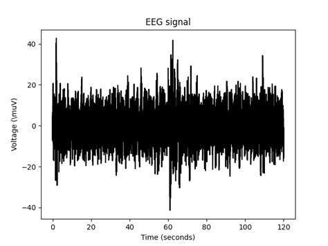Spectralanalysisofeegsignal — Electrical And Neural Signal