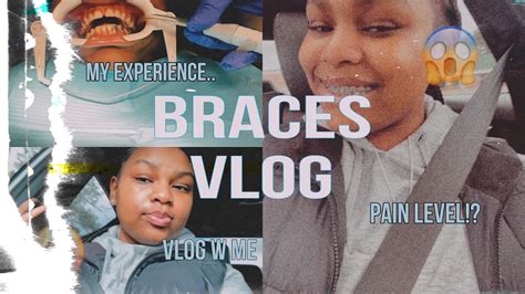 Come With Me To Get My Bracesvlog Youtube