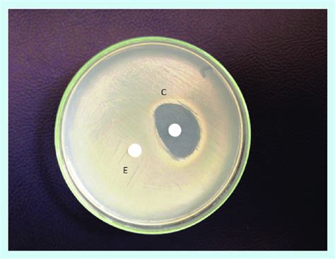 Photograph Of Inducible Clindamycin Resistant D Test Positive Showing Download Scientific