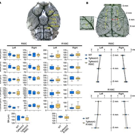 Peri Infarct Spreading Depolarization During Filament Middle Cerebral Download Scientific