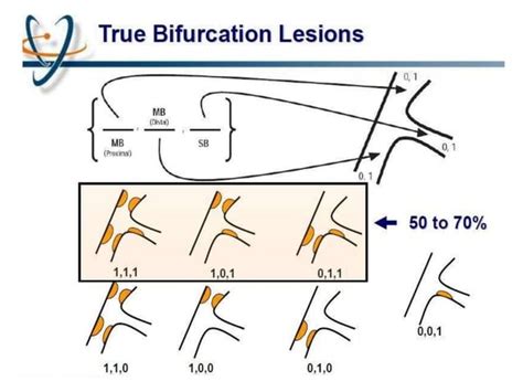 Approach To Coronary Bifurcation Lesions Dr Santhosh 2 1pptx