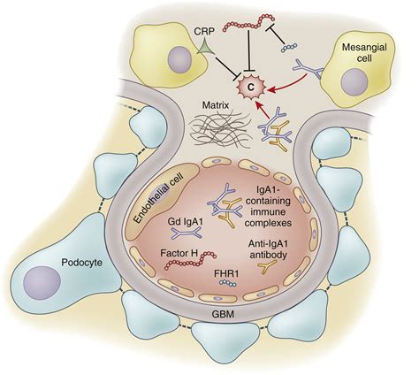 Complement Factor Hrelated Proteins In Iga Nephropathy—sometimes A