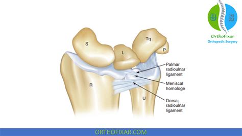 Triangular Fibrocartilage Complex Injury And Treatment 2026