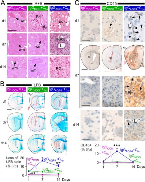 Brain Lesions Caused By Mog Igg And Aqp4 Igg Mice Received