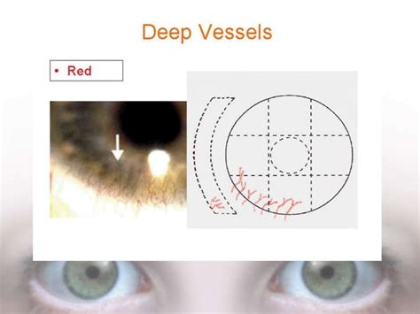Eye Colour Coding