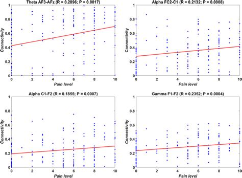 Electroencephalography Functional Connectivity A Biomarker For Painful