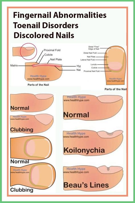 Types Of Toe Nail Diseases With Pictures At Amy Kent Blog