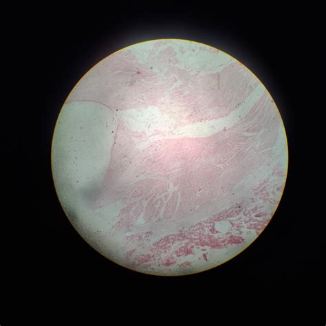 Cartilage Histology Atlas Microscopic Images Histovoid