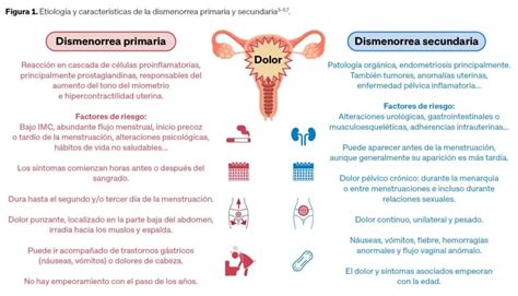 Dismenorrea Aguda Entendiendo El Dolor Menstrual Intenso Doctor Online