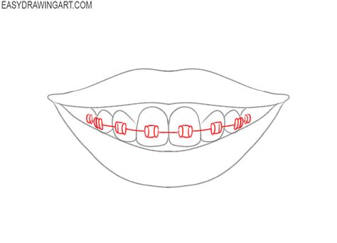 How To Draw Braces Easy Drawing Art