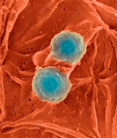 Plasmodium Falciparum Ring Stage Sem Stock Image C0320966