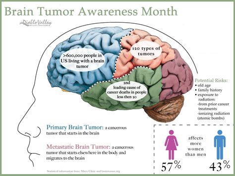 Brain Cancer Anatomy