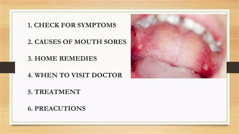Sores And Swelling At Roof Of Mouth Pptx