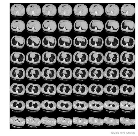 mosmeddata 新冠肺炎胸部 ct扫描数据集上基于3d cnn实现二分类 3d医学影像二分类网络 csdn博客