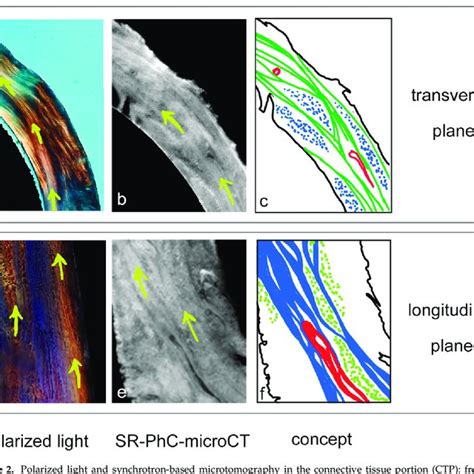 Synchrotron Radiation Based Phase Contrast Microtomography In The Download Scientific Diagram