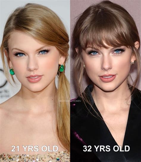 Taylor Swift Botox