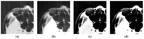 A Rigid Motion Artifact Reduction Method For Ct Based On Blind