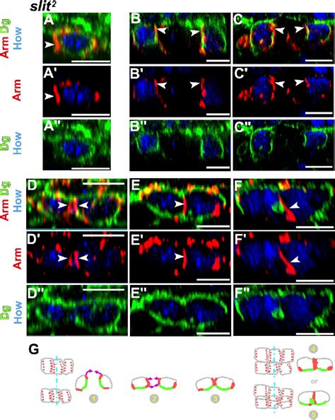 Figure 5 From Genetic Control Of Cell Morphogenesis During Drosophila Melanogaster Cardiac Tube