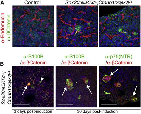 Sox2 Stemprogenitor Cells In The Adult Mouse Pituitary Support Organ