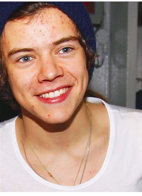 Harry Styles No Teeth