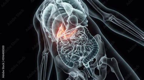 3d Rendering Medical Animation Of A Human Gallbladder X Ray Of A Gallbladder Stock Video Adobe