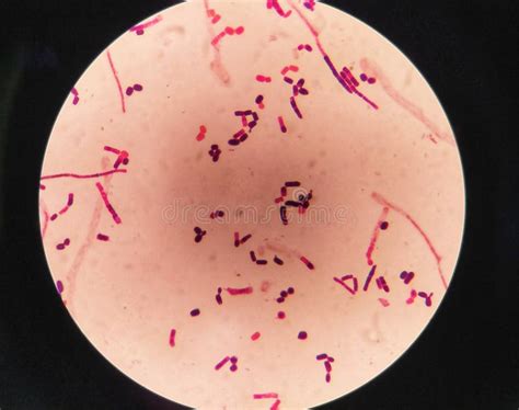 Staphylococcus Gram Stain 100x