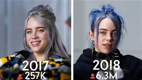 Billie Eilish Before And After Transformations Youtube