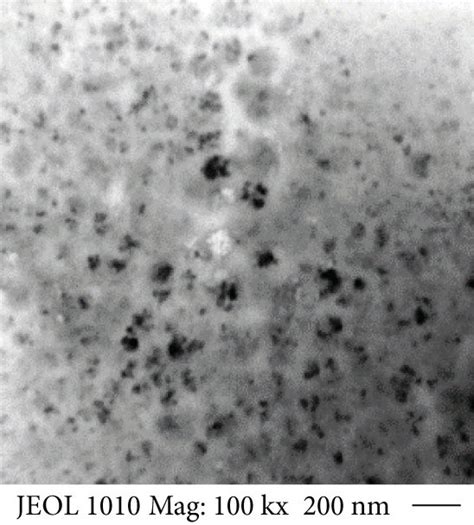 Tem Micrographs Of Pla Cnc Nanocomposites A 0 5 B 1 And C 2