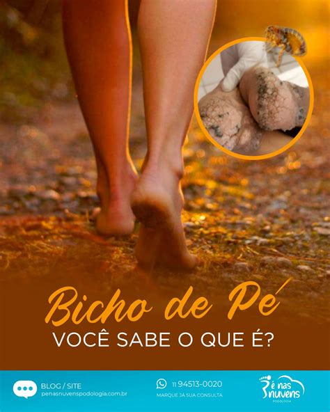 Bicho De Pé Você Sabe O Que é Pé Demais Podologia E Bem Estar