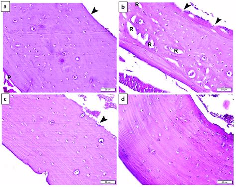 A Photomicrograph Of Transverse Section Ts In The Cortical Compact Download Scientific