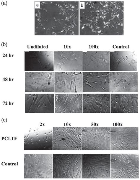 Phase Contrast Micrograph Showing The Spindle Shaped Fibroblastic